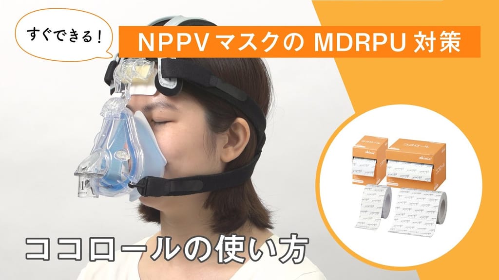 NPPVのリーク量に関するガイドライン - Genspark